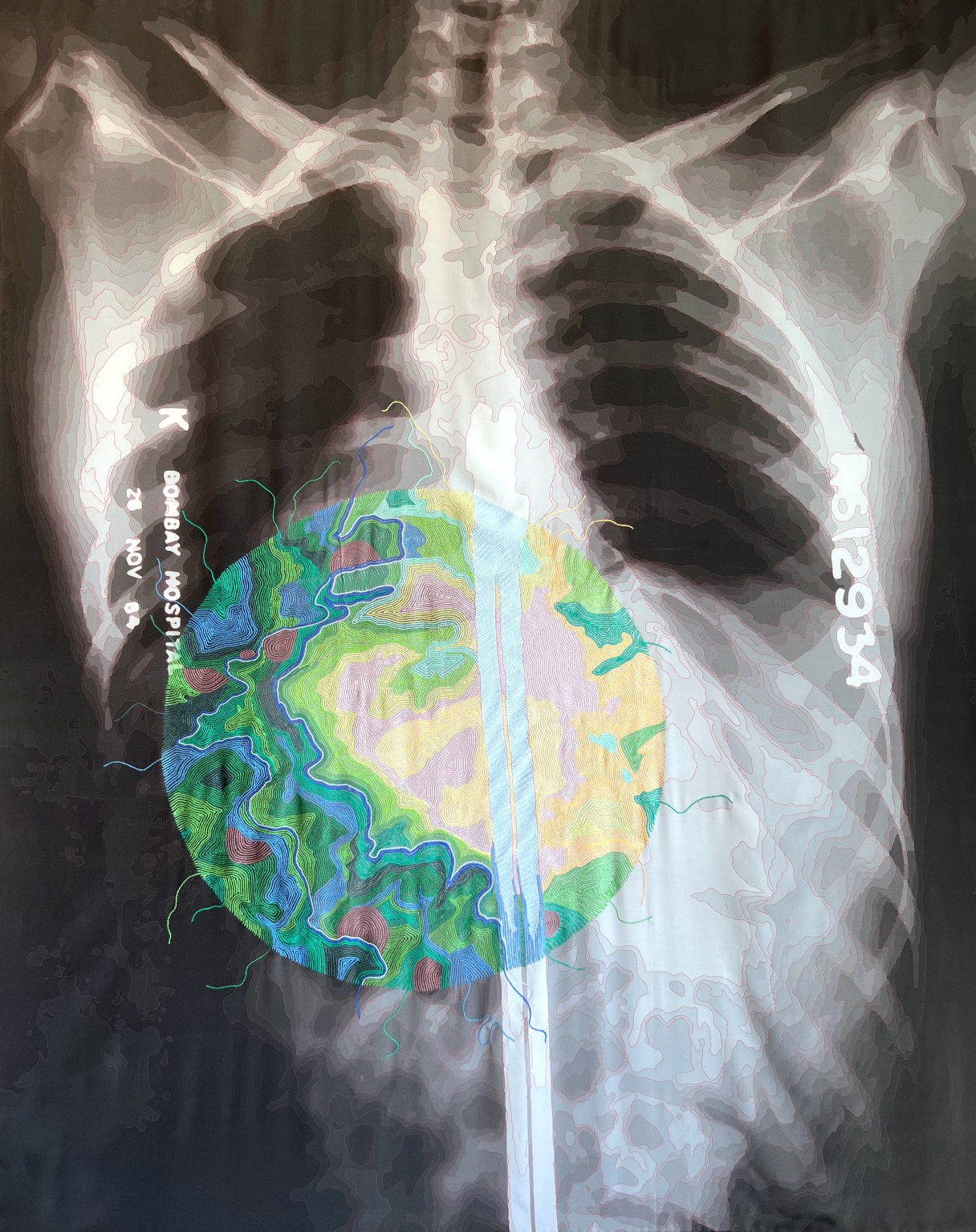 Disability, Empowerment, and Art: On Hospital Aesthetics with Amanda ...